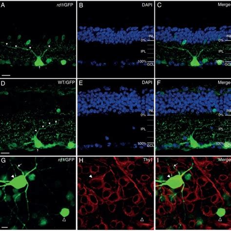 Pdf Retinal Ganglion Cells Are Resistant To Photoreceptor Loss In