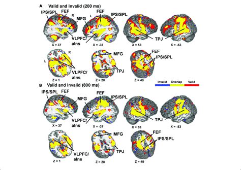 Results From Post Hoc T Tests Comparing Activation During Both Valid Download Scientific