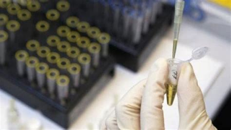 Vacuna Contra ébola Llega A Oms La Silla Rota