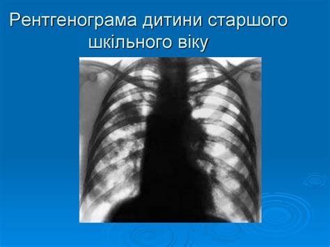 Ембріогенез серцево судинної системи і вроджені аномалії серця та судин