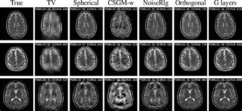Figure 1 From Differentiable Gaussianization Layers For Inverse Problems Regularized By Deep