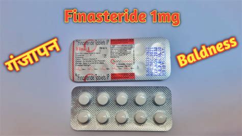 Finasteride Tablet 1mg Uses गंजापन Kaise Thick Kare Hair Loss Problem Alopecia Treatment