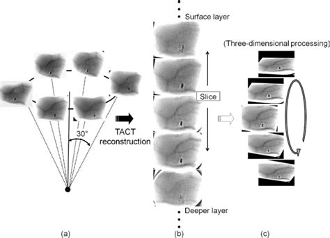 Qualitative Near Infrared Vascular Imaging System With Tuned Aperture Computed Tomography