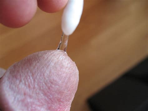 Penis Insertions Pics Xhamster