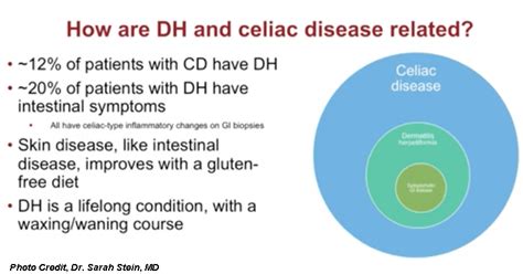 Answered Questions About Dermatitis Herpetiformis