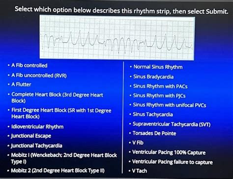 Solved Select Which Option Below Describes This Rhythm