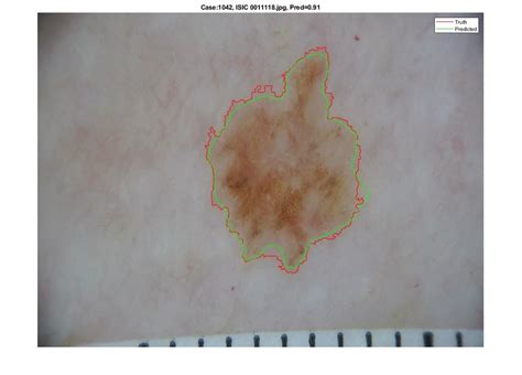 Two Example Segmentations With 0 90 Overlap Score Download Scientific Diagram