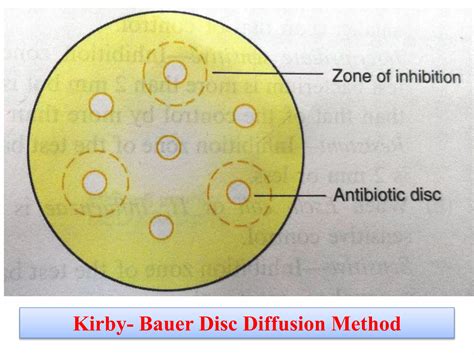 Antimicrobial Sensitivity Test Pptx