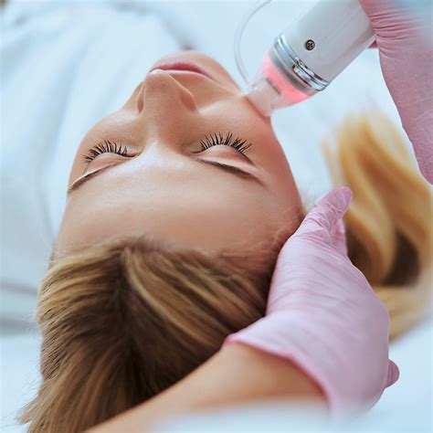 Medcare Aesthetics Radiofrequency Microneedling