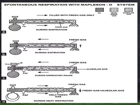 Anaesthesia Breathing Circuits And Its Classification And Functional
