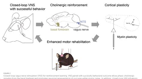 Figure 1 From Proceedings Of The 11th Annual Deep Brain Stimulation