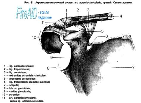 Что такое акромиально ключичный артрит