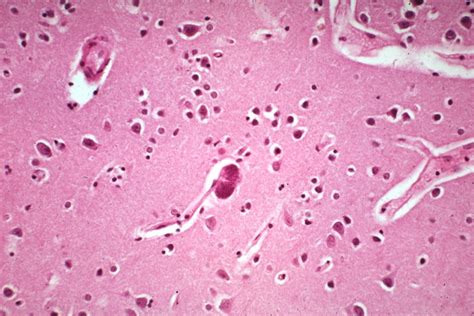 00001007 Peir Digital Library