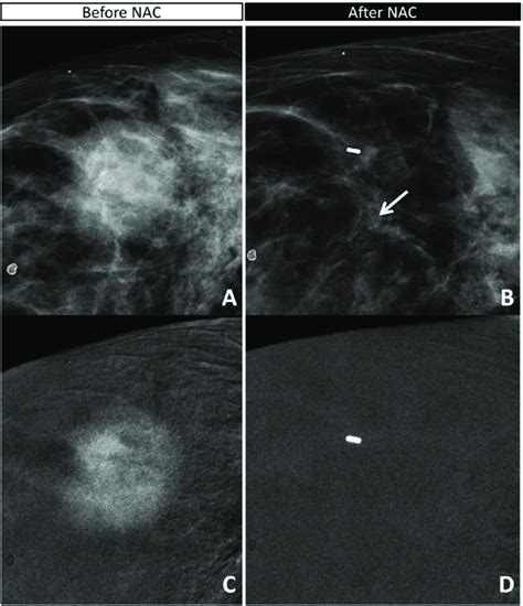 False Positive For The Combined Evaluation And True Negative For The Ce Download Scientific