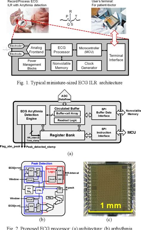 figure 1 from a 17 7 pj cycle ecg processor for arrhythmia detection