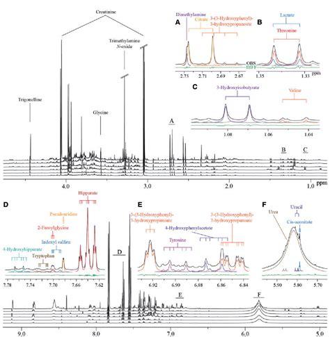 Figure 1 From Of Concept For Quantitative Urine Nmr Metabolomics