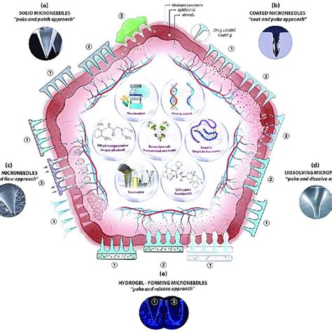 Clinical Trials Of Microneedle Mediated Delivery Of Macromolecules