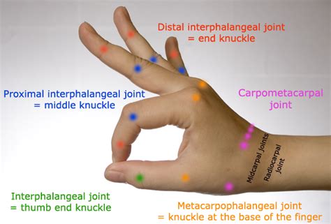 Carpal Metacarpal Joint Injection