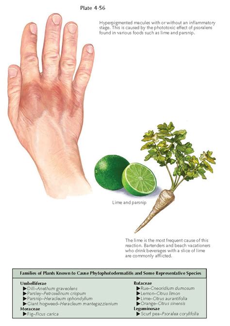 Phytophotodermatitis Pediagenosis