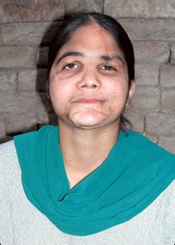 Sundeep Karu Severed Face For Best Astrology Consult Dr Lectivac