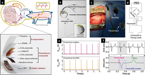 Fem‐powered Cardiac Pacemaker A The Schematic Illustration For Direct
