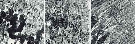 Electron Micrographs Showing The Outer Segments OS And Inner Segments Download Scientific