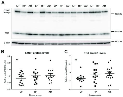 Txnip And Trx Levels In Low Plaque Lp High Plaque Hp And Download Scientific Diagram