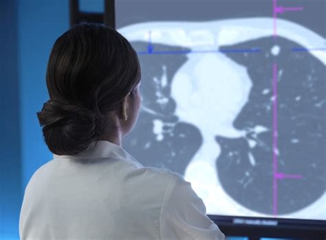 Ion Robotic System For Bronchoscopy Robotic Technology
