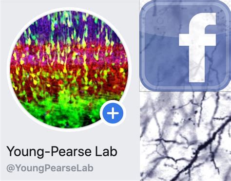 Projects Young Pearse Lab