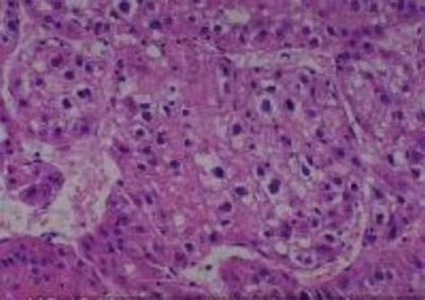 Novus Biologicals™ Human Multi Tissue Tissue Microarray Cancer Human