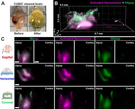 Light Sheet Fluorescence Microscopy Lsfm Of Cleared Tissues Enables