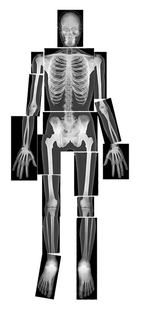 Xray Black And White Clipart
