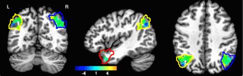Task Responsive Voxel Activity Task Vs Iti Fixation Baseline In Left