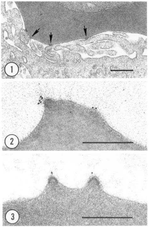 Figure 1 From Plasmodium Falciparum Infected Erythrocyte Receptor S For Cd36 And Thrombospondin