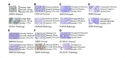 validation of hub rbp expression in ucec and normal tissue from the hpa