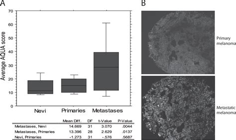 Figure From Gab Mediated Signaling Promotes Melanoma Metastasis Semantic Scholar