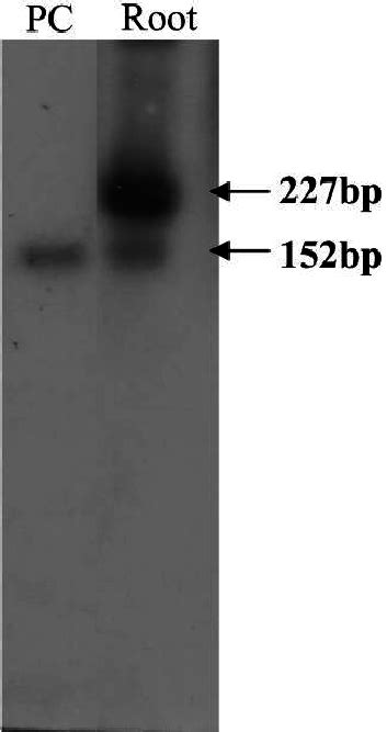 Pcr Southern Blot Analysis Confirmation Of Exon Skipping In