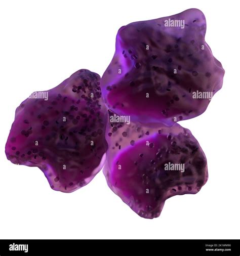 Diffuse Large B Cell Lymphoma Illustration Stock Photo Alamy