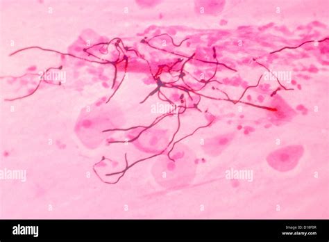 Light Micrograph Candida Albicans In Lung Tissue Stock Photo Alamy