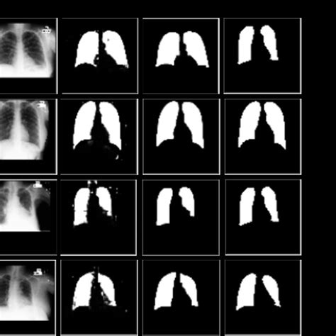 segmentation result for the whole x ray a original x ray b