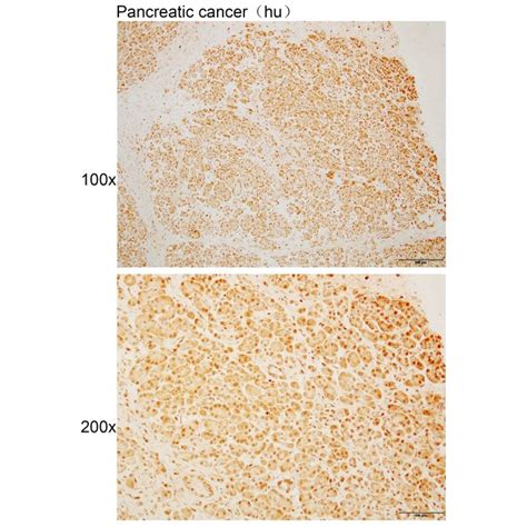 Solarbio K110538p Anti Rfesd Polyclonal Antibody 试剂仪器耗材