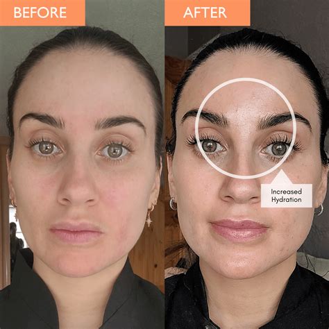 Skinician Reviews Skinician