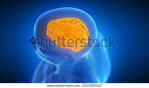 3d Rendered Medical Illustration Degenerated Human Stock Illustration