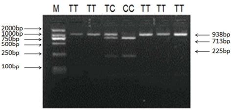 Pcr Restriction Fragment Length Polymorphism Pcr Rflp Results Of