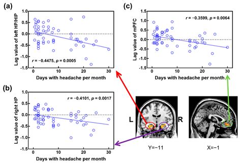 Propagation Structure Of Intrinsic Brain Activity In Migraine Without Aura