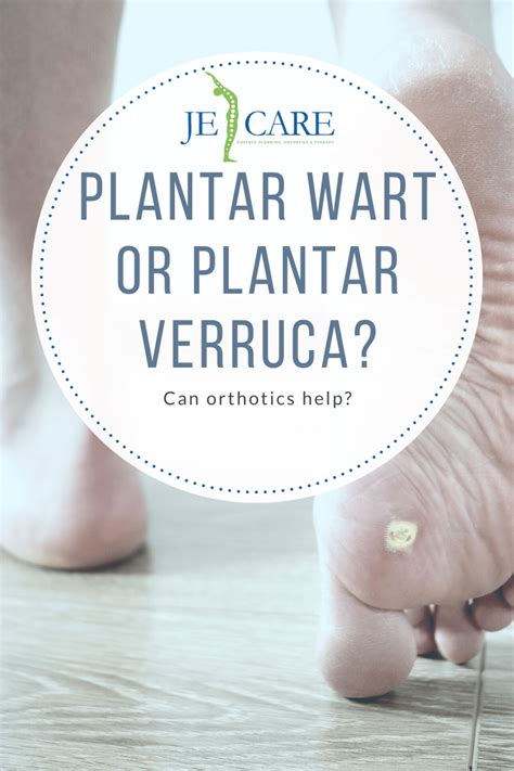 Plantar Wart Or Plantar Verruca Je Care And Consultants Ltd
