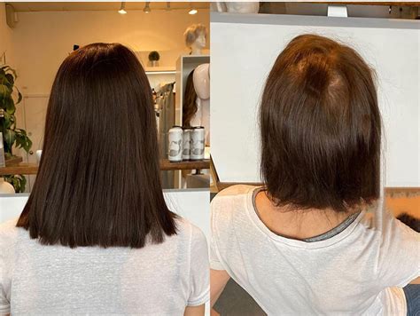Natural Straight Hair Topper New Design【buy 2 For Free Shipping】 Monwigs