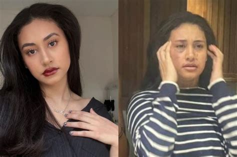Afifah Riyad Diduga Alami Kdrt Hingga Wajah Babak Belur Ntvnewsid