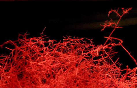 Embolia Causas Síntomas Y Prevención Médica