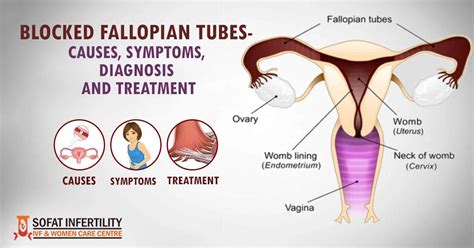 Diagram Diagram Of Fallopian Tube Mydiagramonline